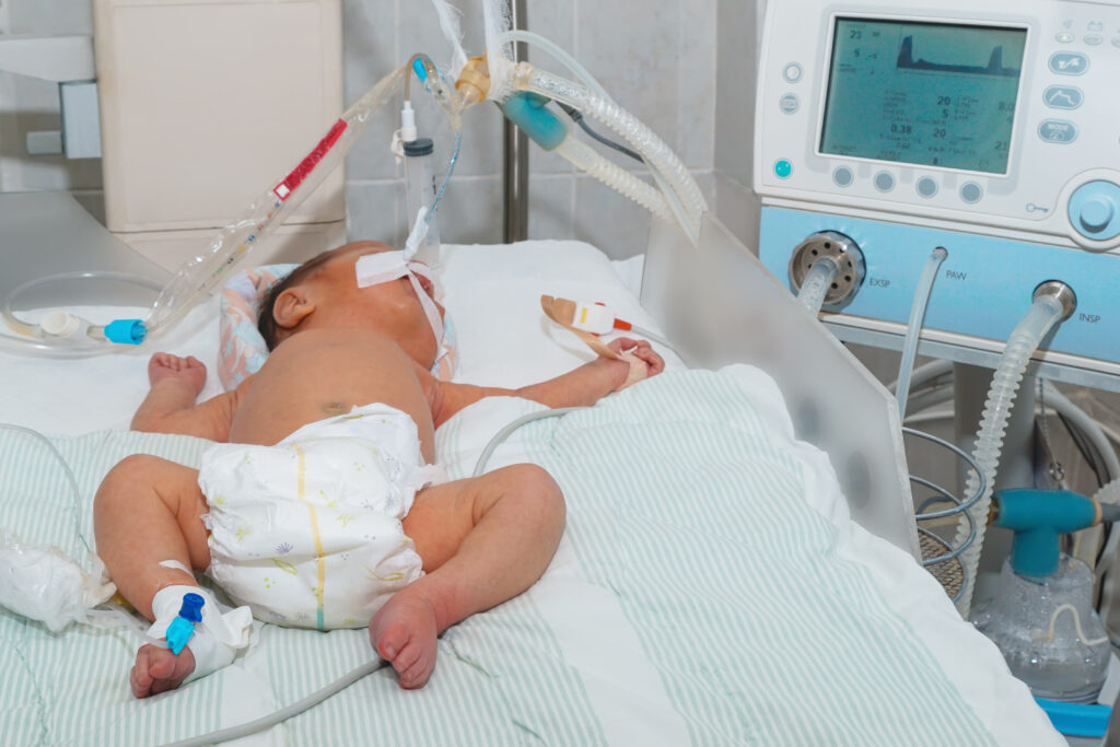 Case Study: Neonatal Hypoxic Ischemic Encephalopathy (HIE) - Pediatric ...