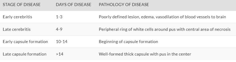 Brain Abscess in Children - Pediatric Medical Experts