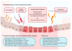 Abdominal Pain Part I: Acute Abdominal Pain, Necrotizing Enterocolitis ...