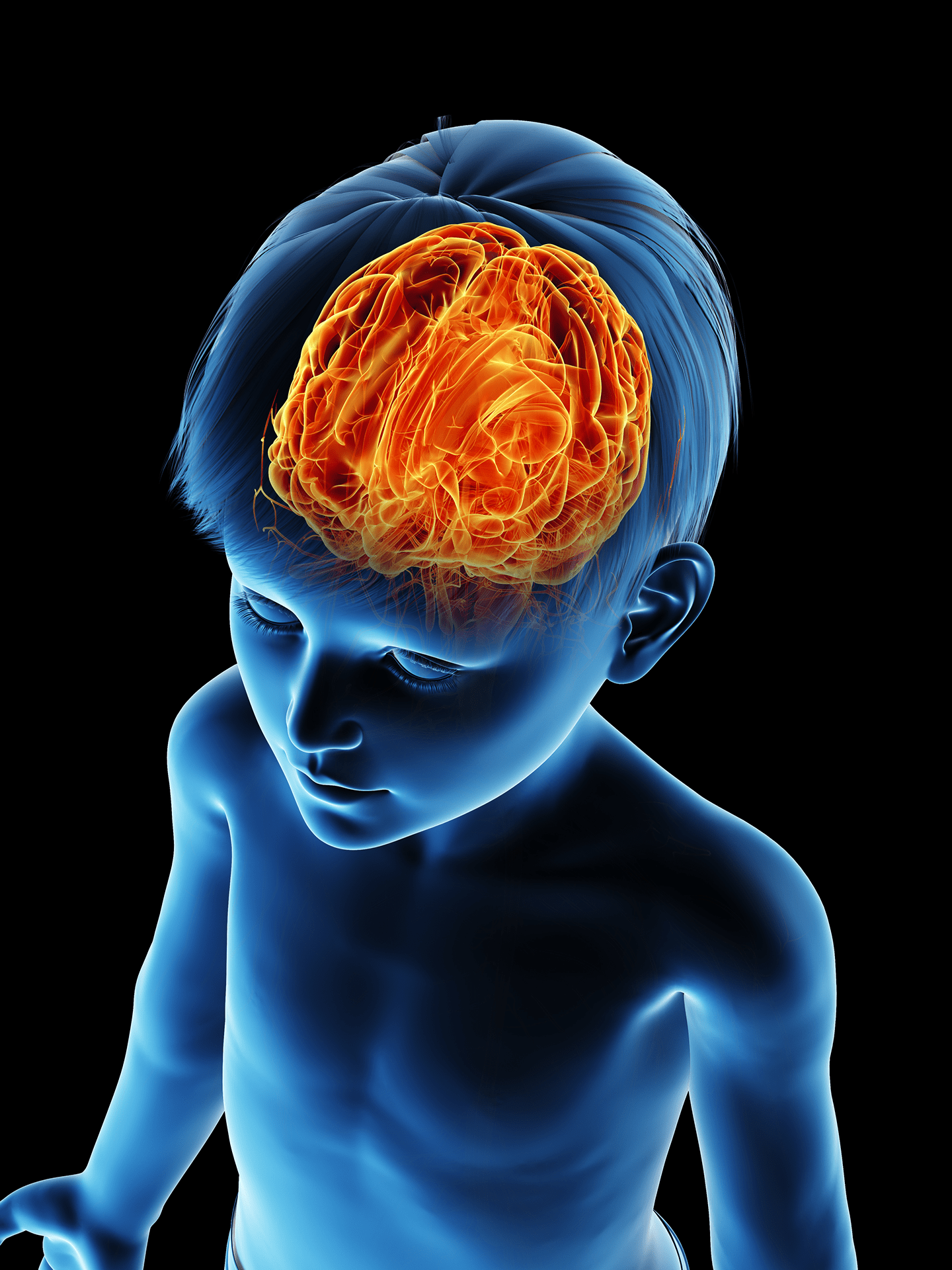Headaches in Children - Pediatric Medical Experts